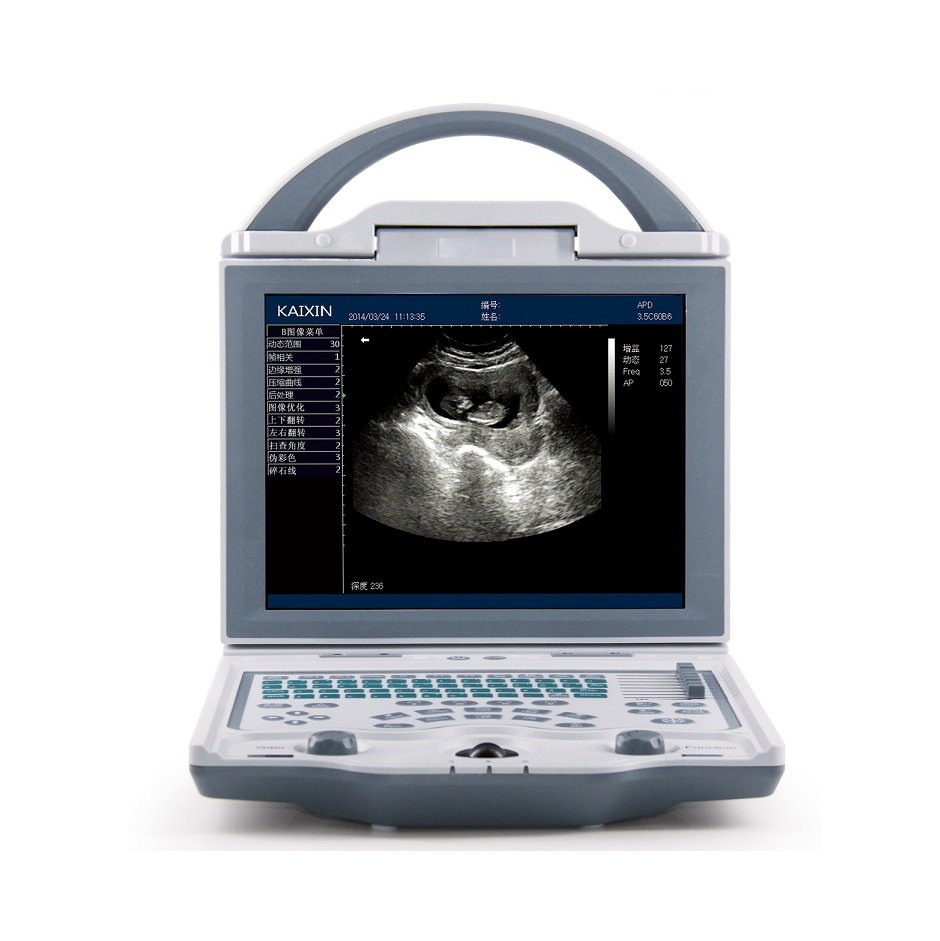 Rechargeable Human Ultrasound Scanner -KX5600 - Oxygen Machine